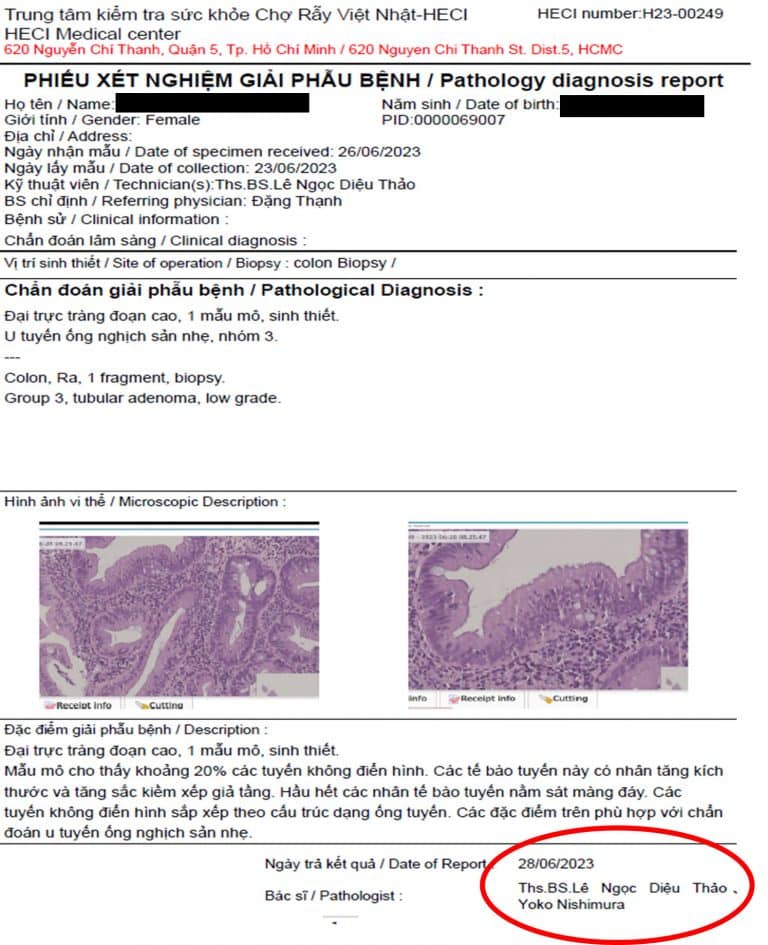 ADVANTAGES OF THE HEALTH SCREENING PACKAGE FOR DISEASES, CANCER, AND ...